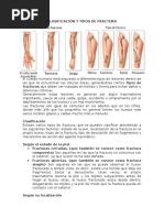 Tróclea - Qué Es, Significado, Ubicación, Función y Lesiones | PDF ...