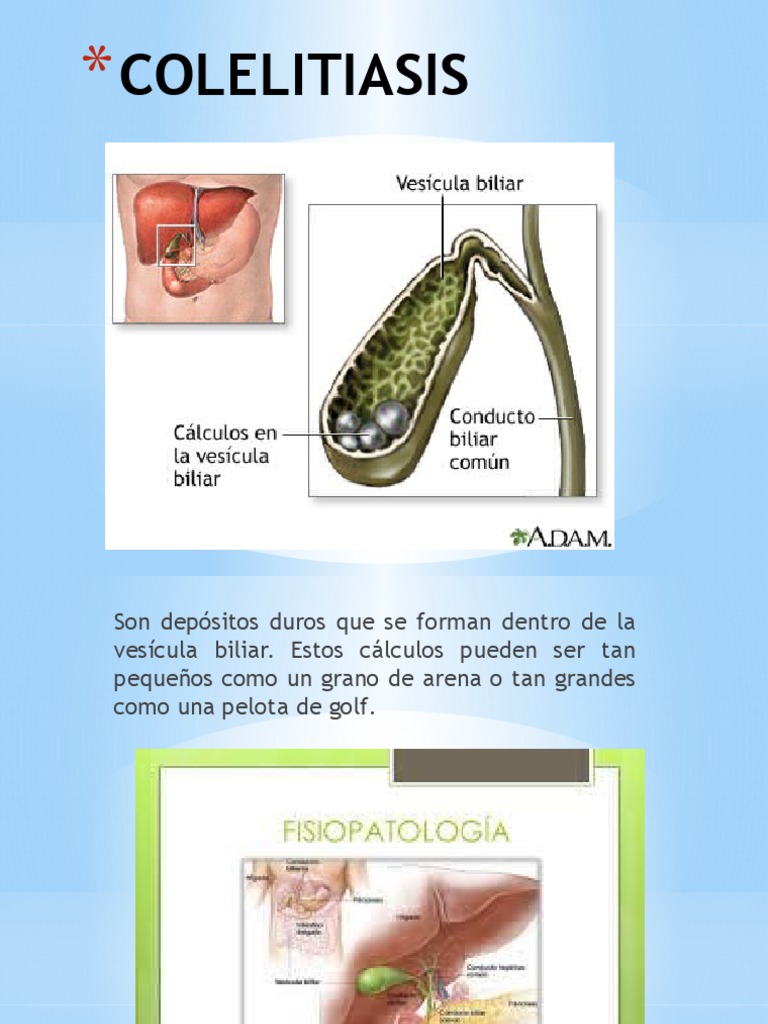 COLELITIASIS | PDF | Bilis | Sistema exocrino