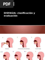 Método MECV-V para Evaluar Disfagia | PDF | Medicina | Enfermedades y ...