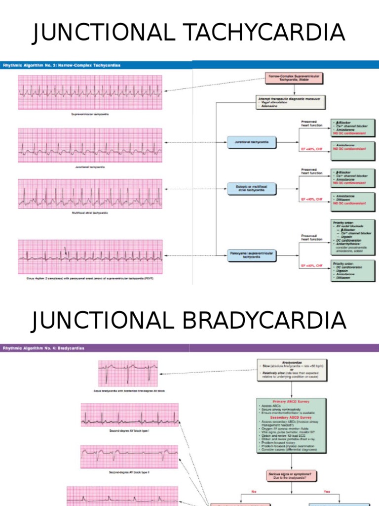 Junctional Rhythm | PDF