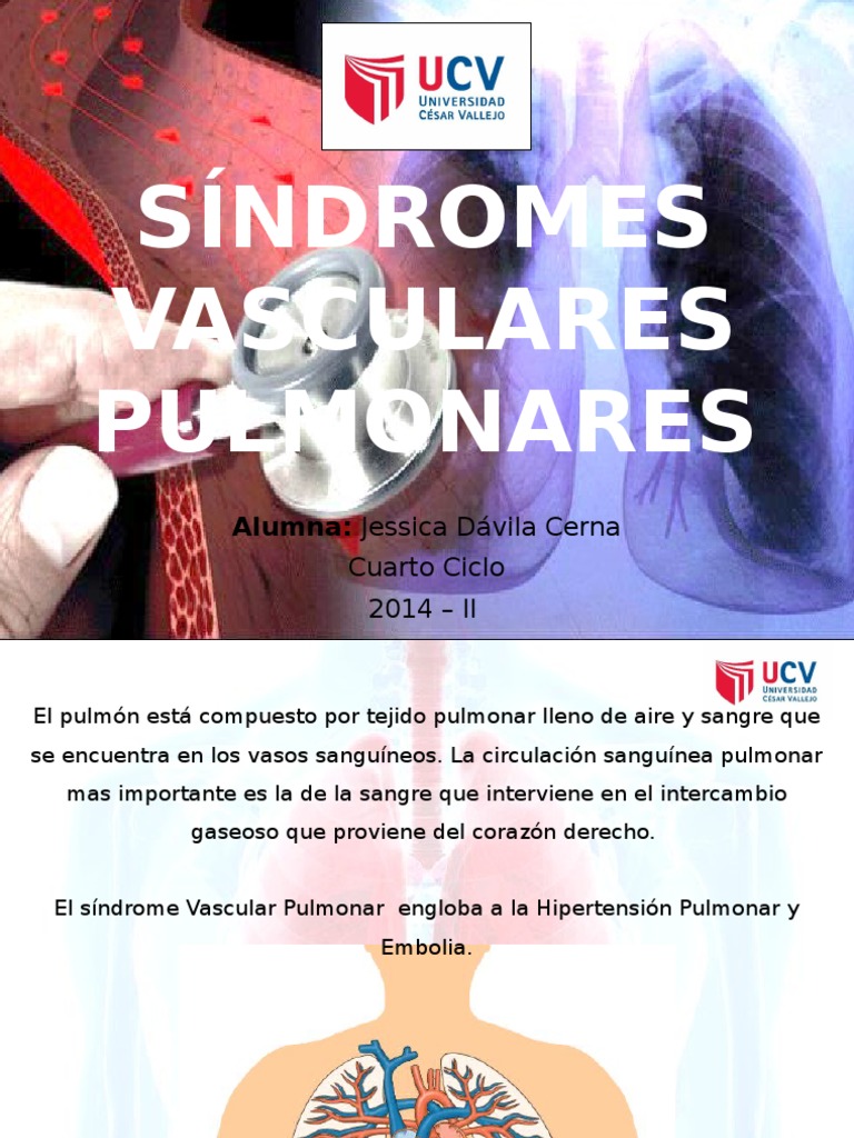 Sindromes Vasculares Pulmonares | PDF | Embolia | Pulmón