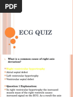 Ecg MCQS | PDF | Electrocardiography | Cardiology