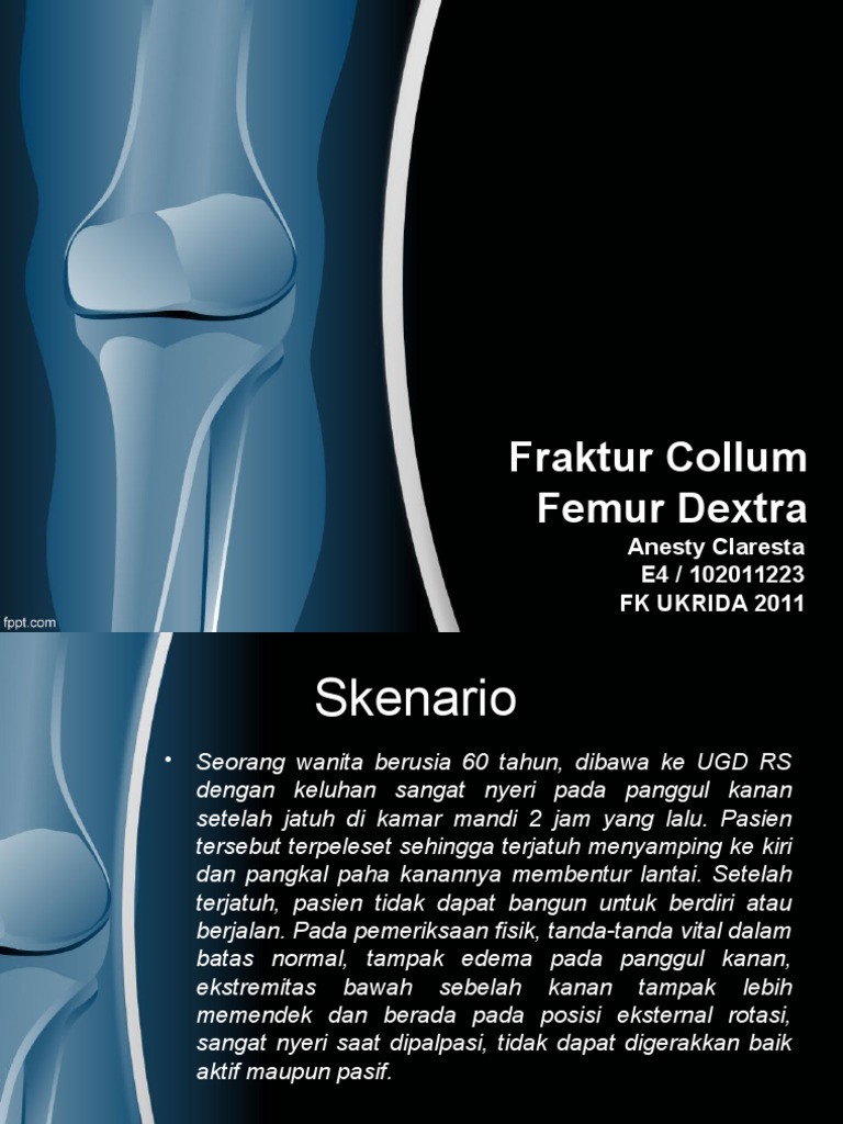 Fraktur Collum Femur | PDF