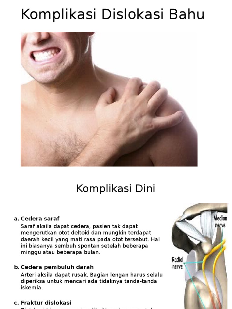 Komplikasi Dislokasi Bahu | PDF