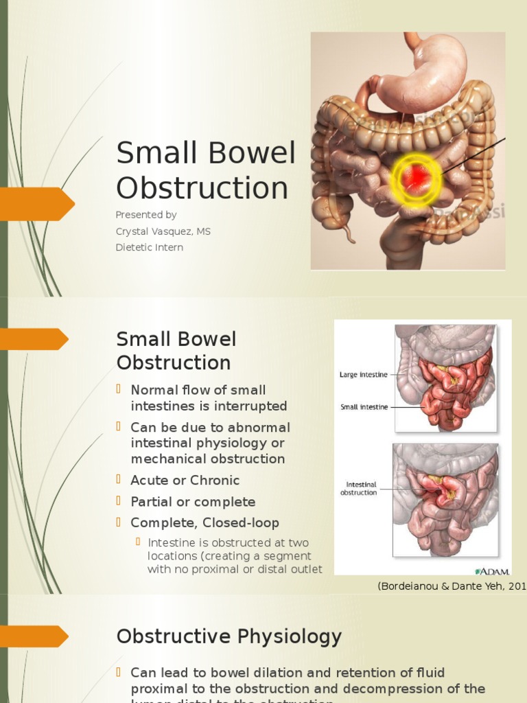 Case Study Presentation | PDF | Nausea | Constipation