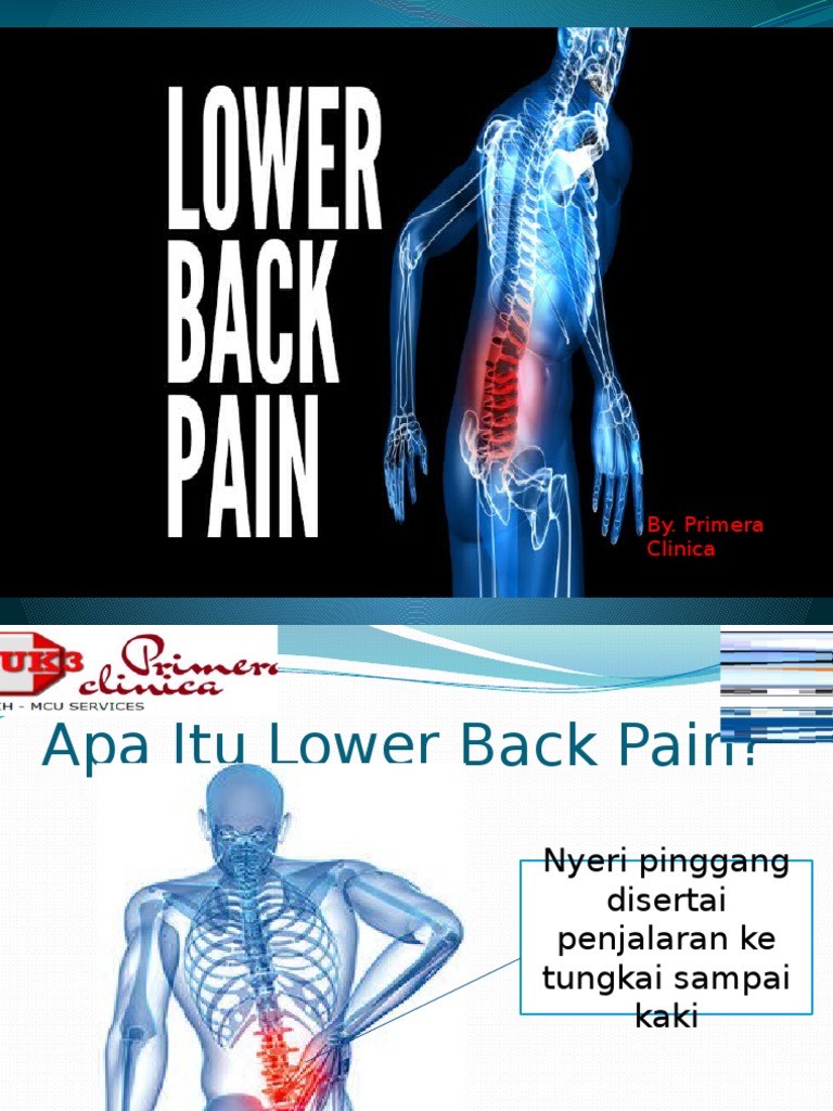 Low Back Pain | PDF | Pengembangan Diri