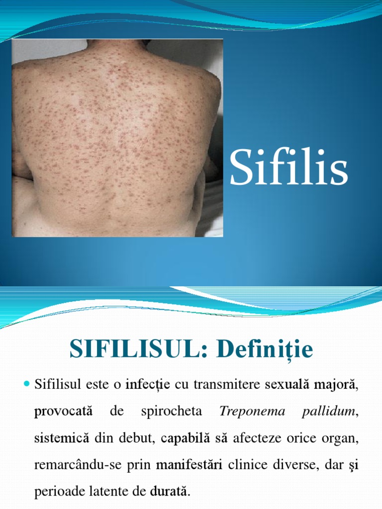 Sifilis