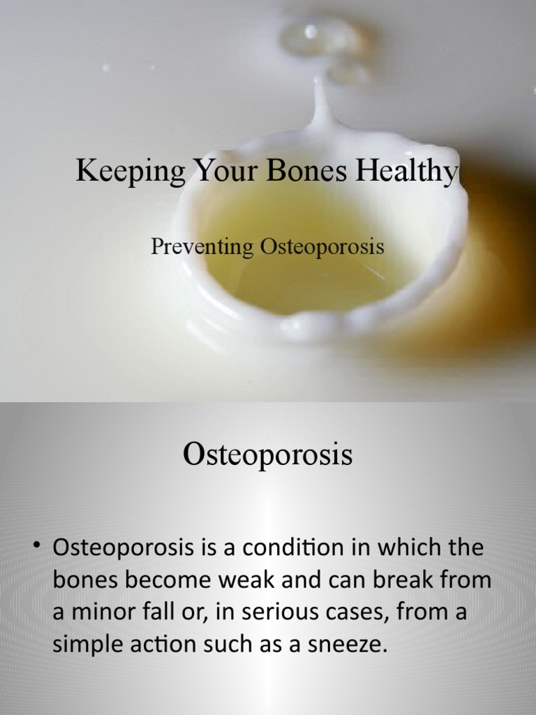 Keeping Your Bones Healthy | PDF | Osteoporosis | Abdomen