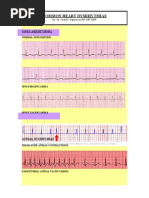 ECG - EKG Practice Quiz (Identify Rhythms) | PDF | Electrocardiography ...