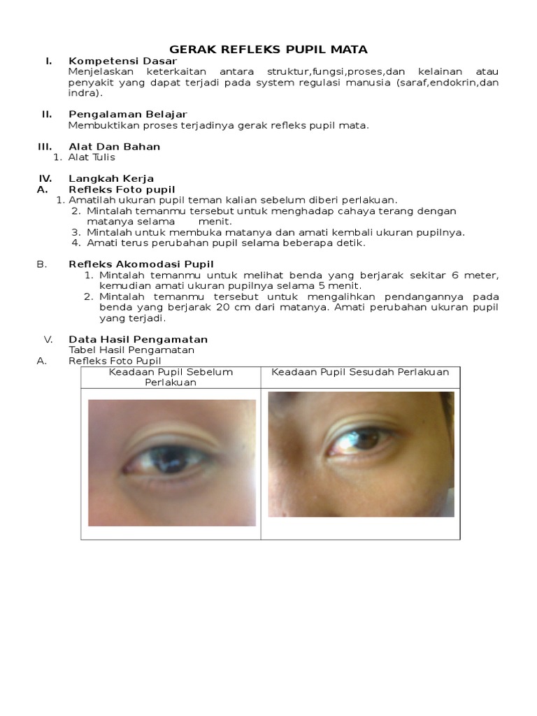 Gerak Refleks Pupil Mata 2 | PDF