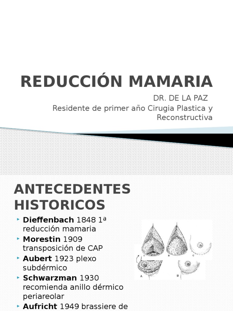 Reducción Mamaria y Mastopexia | Características sexuales secundarias ...