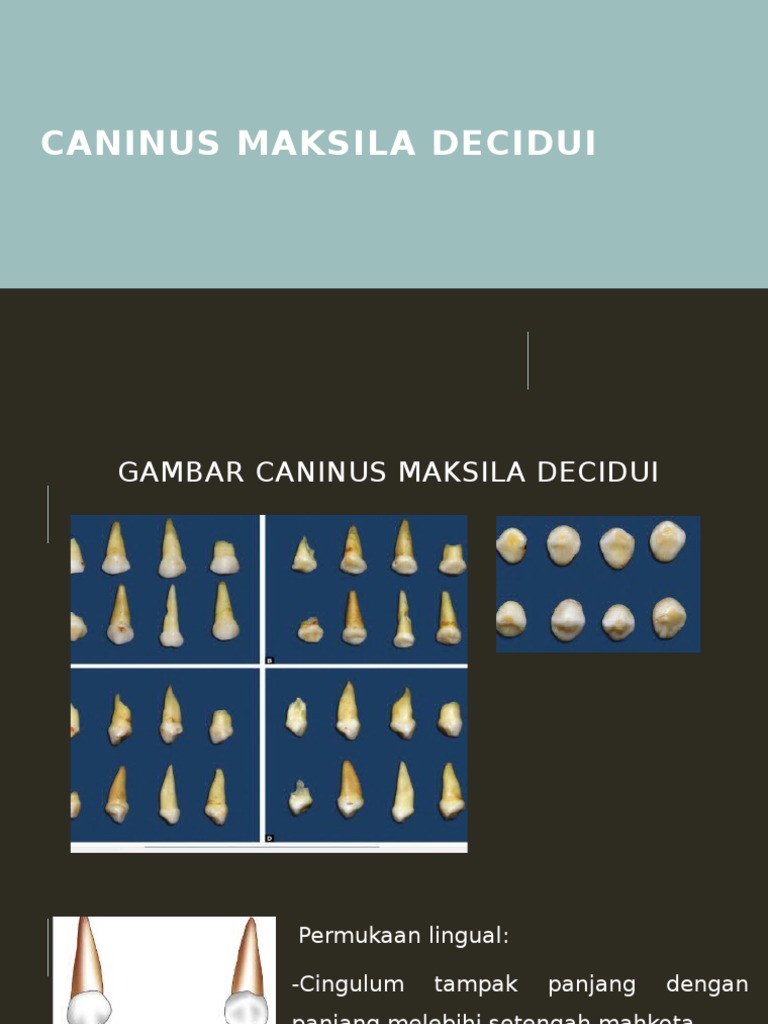 Caninus Maksila Decidui | PDF