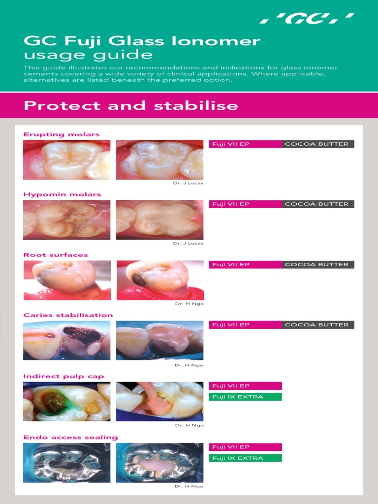 GIC Fuji | Dentistry | Mouth