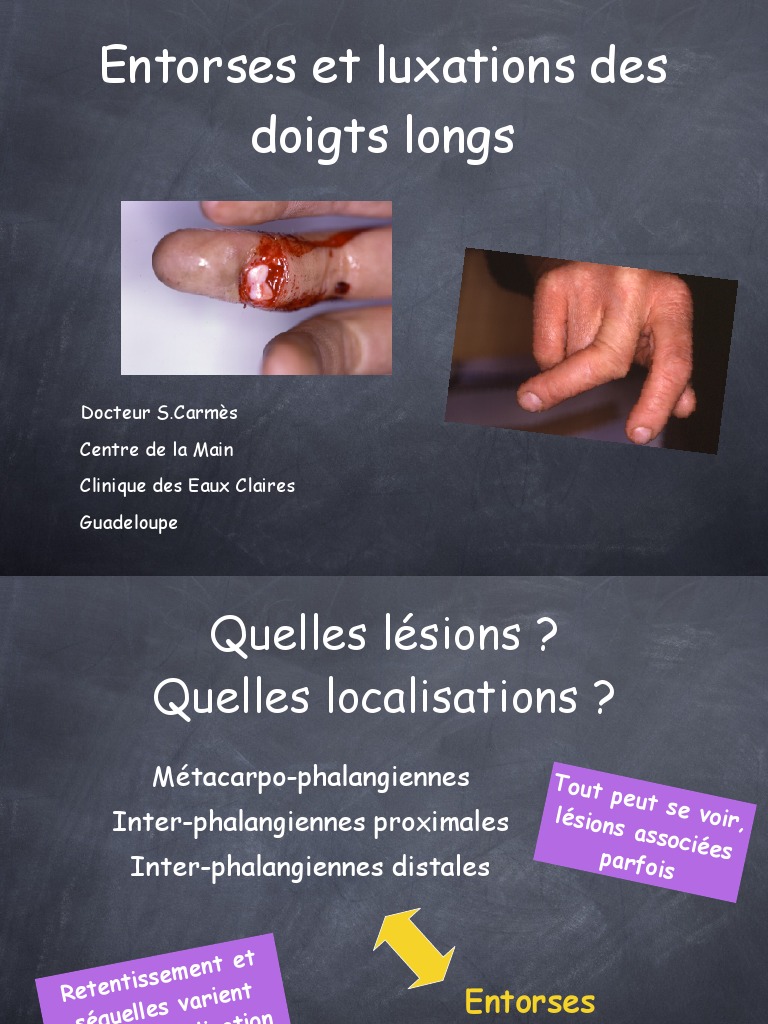 Entorses Et Luxations Des Doigts Longs 2017