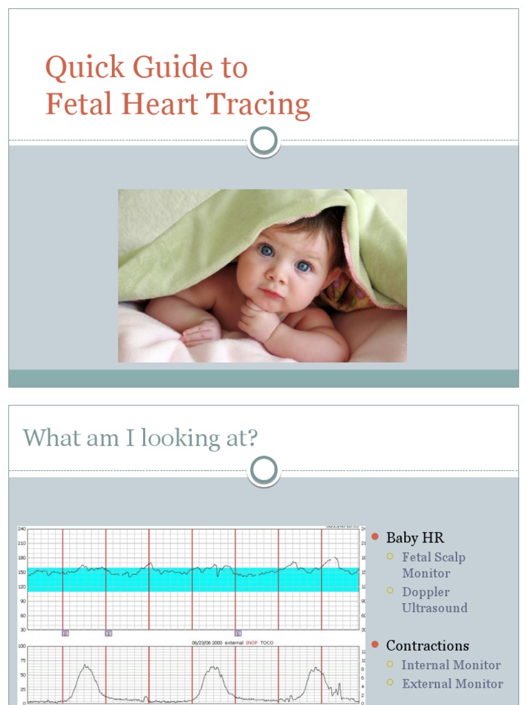 Fetal Heart Tracing | PDF