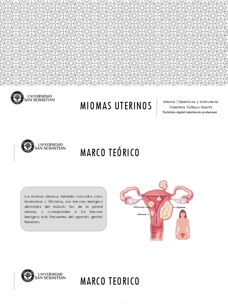 Miomas Uterinos | PDF | Ginecología | Medicina CLINICA