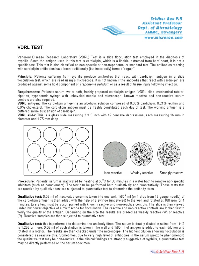 VDRL Test: Principle, Procedure, Result Interpretation And, 41% OFF