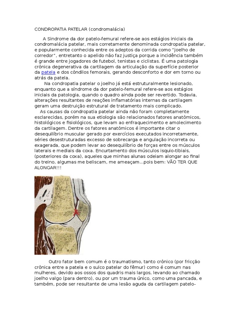 Condropatia Patelar | Joelho | Sistema Locomotor