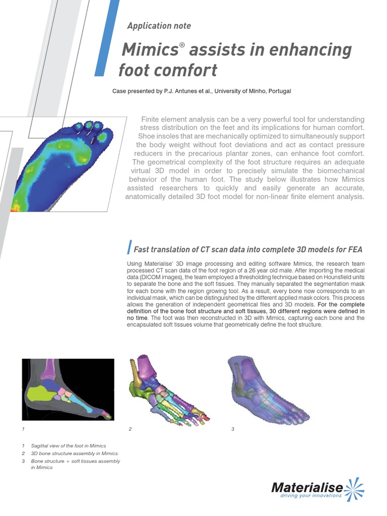 Mimics Assists in Enhancing Foot Comfort: Application Note | PDF ...