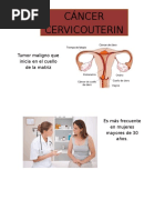 Triptico Cáncer Cervicouterino | PDF | Cáncer de cuello uterino | Cáncer