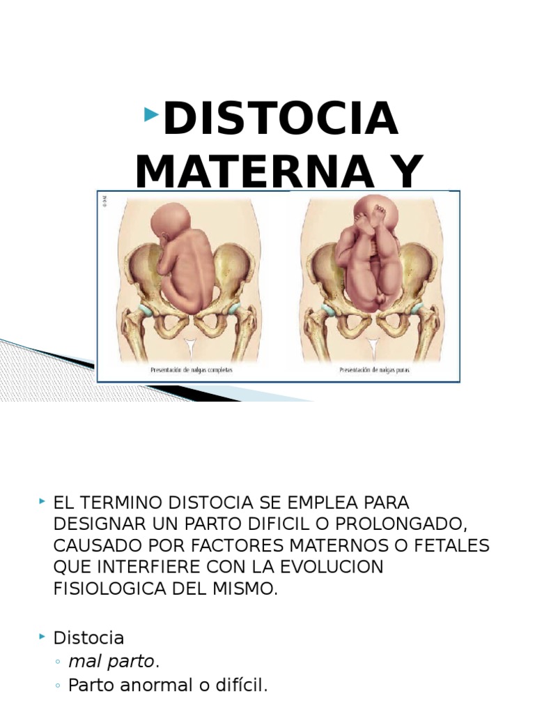 Distocia 160716014242 | PDF | Parto | Salud maternal