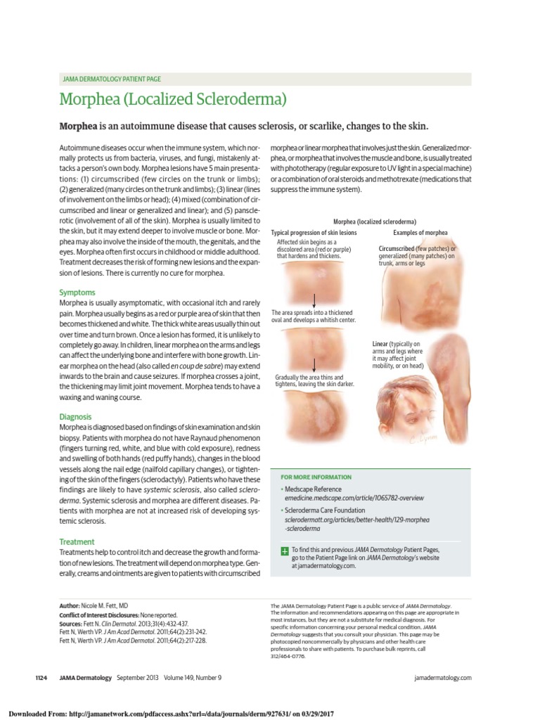 Morphea (Localized Scleroderma) : Is An Autoimmune Disease That Causes Sclerosis, or Scarlike ...