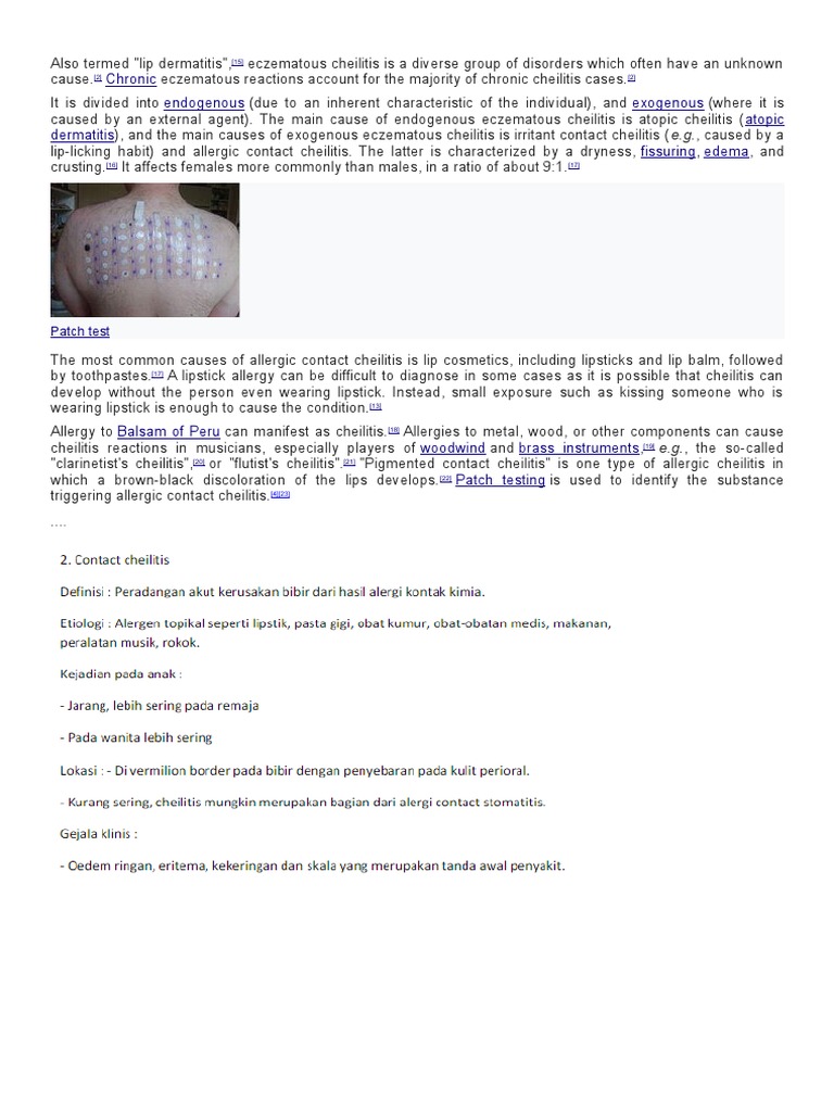 Chronic Endogenous Exogenous Atopic Dermatitis Fissuring Edema | PDF ...