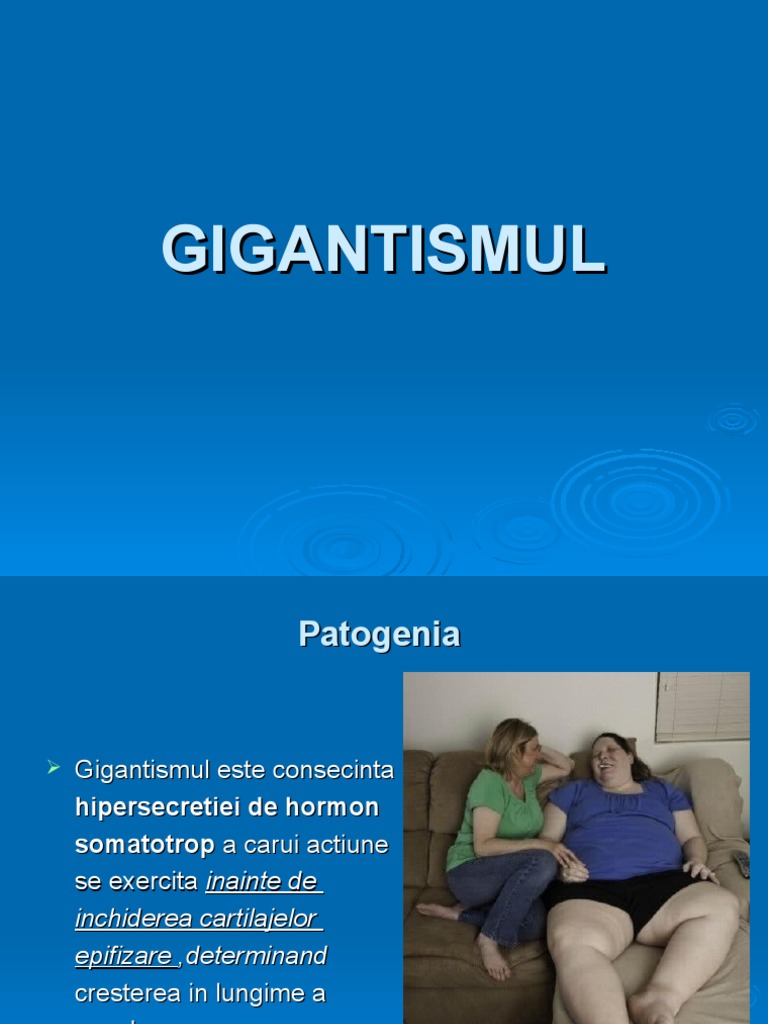 gigantism-ul-pdf
