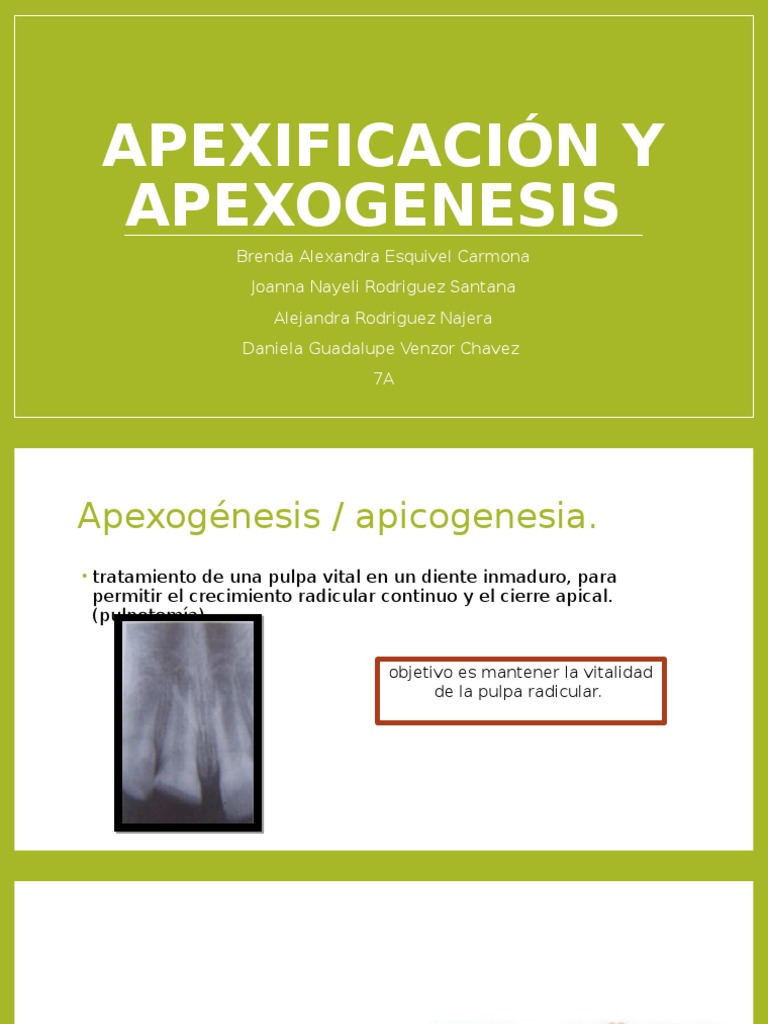 Apexificación y Apexogénesis | PDF | Diente humano | Calcio