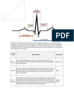 Left Anterior Fascicular Block (LAFB) - LITFL - ECG Library Diagnosis ...
