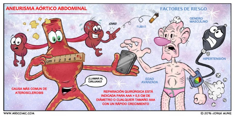 Aneurisma de La Aorta Abdominal (Medcomic) PDF | PDF
