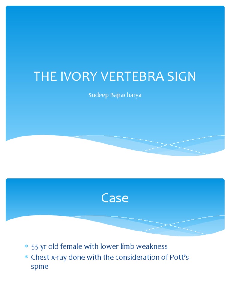 The Ivory Vertebra Sign | PDF | Bone | Vertebral Column