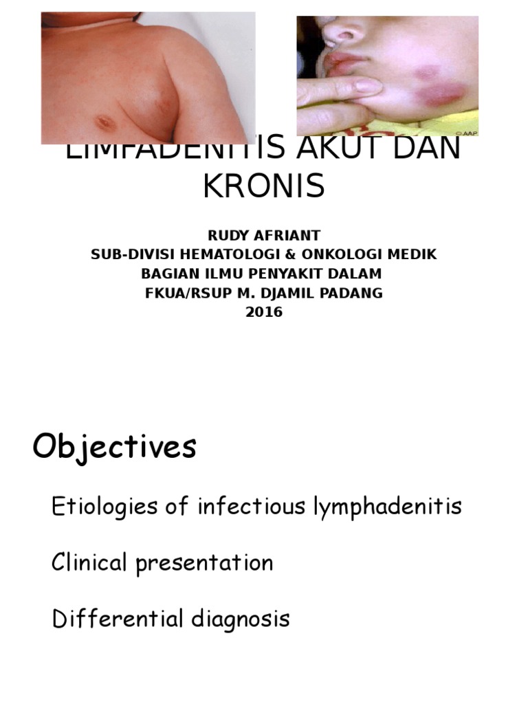 Limfadenitis Akut Dan Kronis | PDF | Veterinary Medicine | Diseases And ...