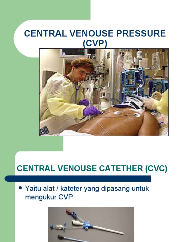 Central Venouse Pressure (CVP) | PDF