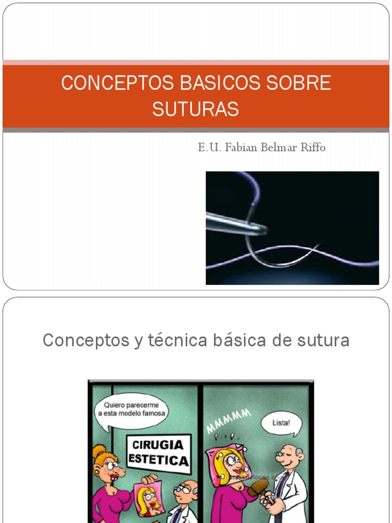 Conceptos Basicos Sobre Suturas | PDF | Sutura Quirúrgica | Fibra sintética