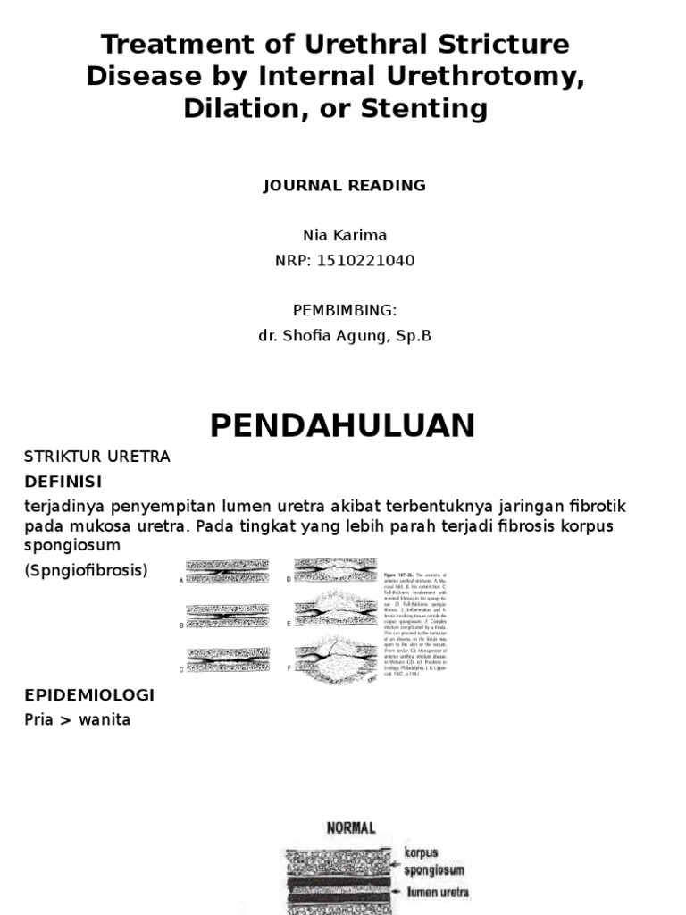 Striktur Uretra | PDF