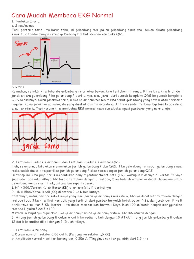 Cara Mudah Membaca EKG Normal