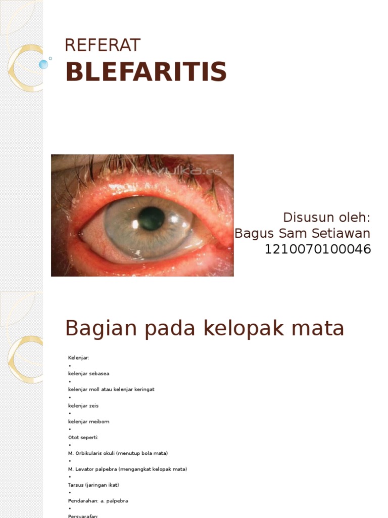 BLEFARITIS | PDF
