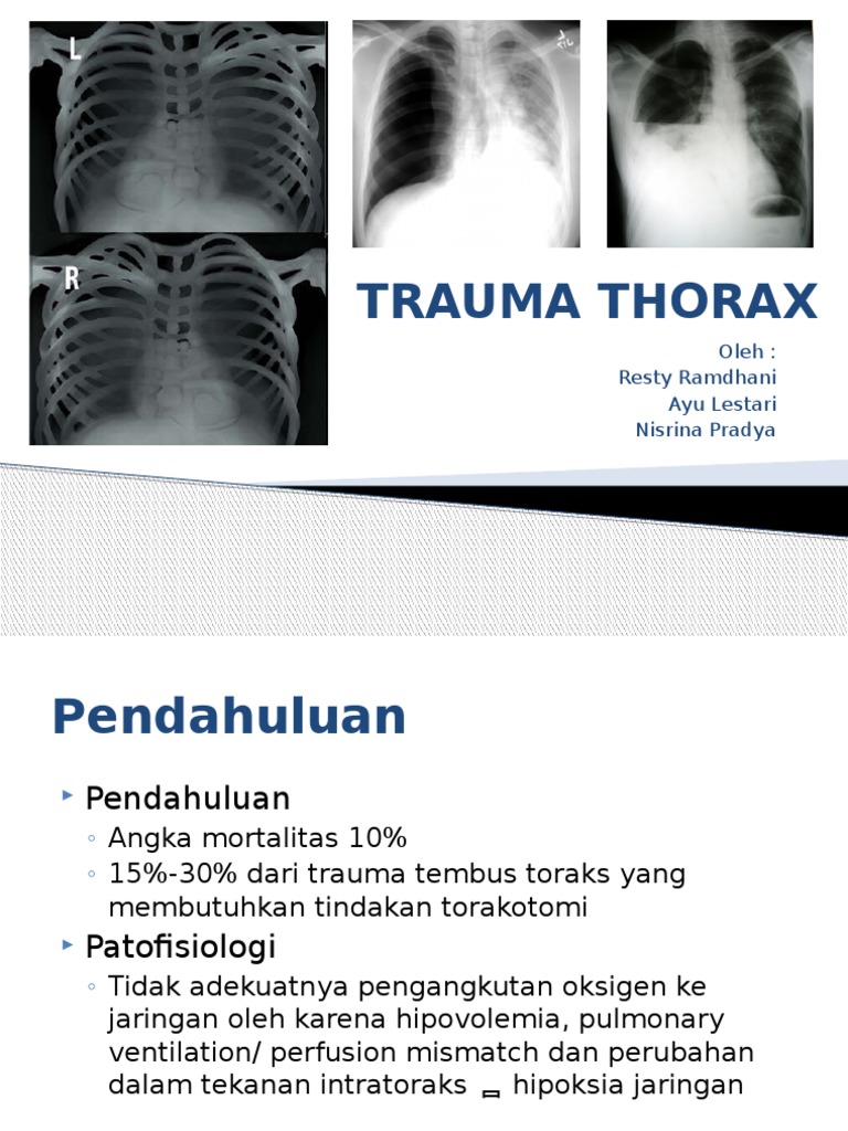 Trauma Thorax | PDF