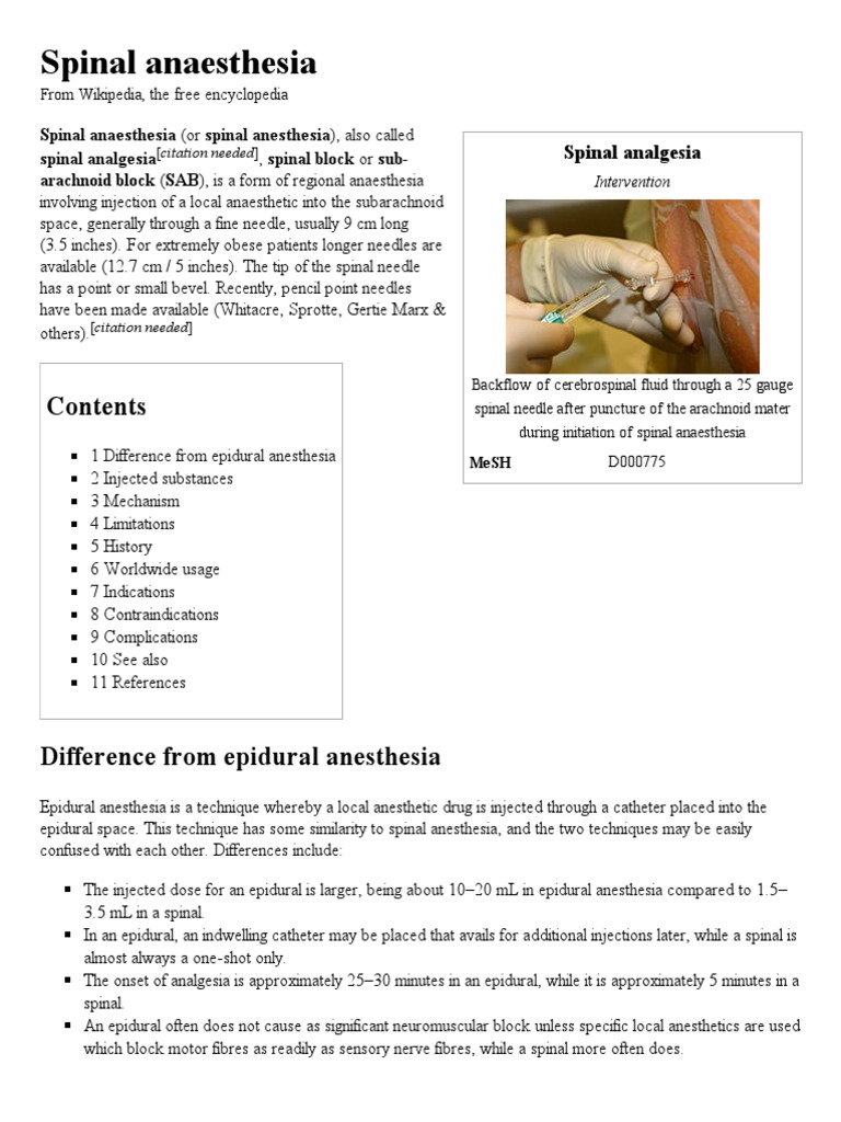 Spinal Anaesthesia - Wikipedia, The Free Encyclopedia | PDF | Pain ...