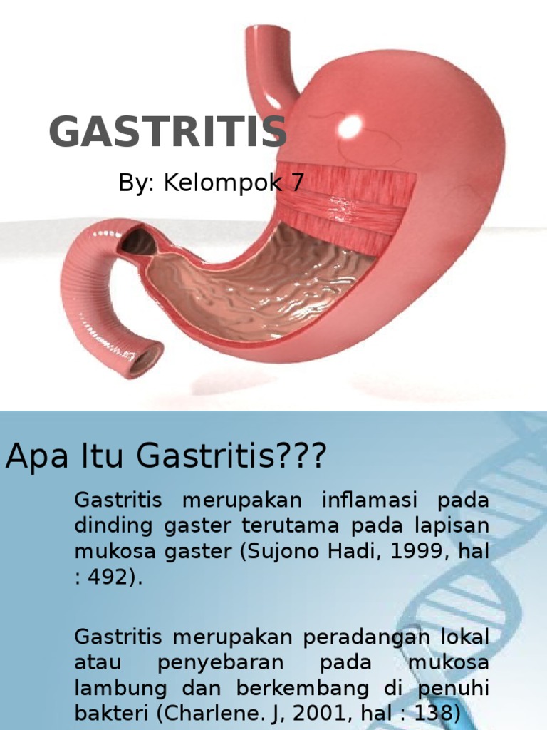 Apa Itu Gastritis | PDF