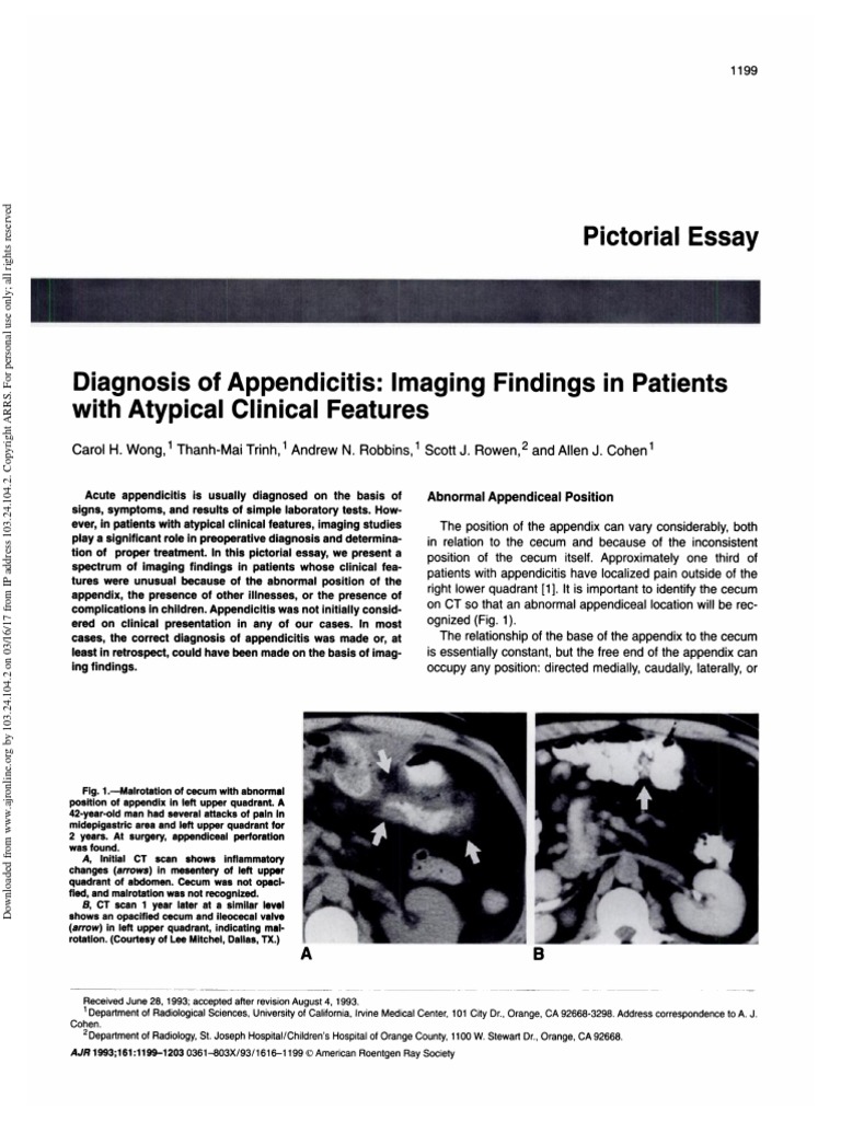 Pictorial Essay: Abnormal Appendiceal Position | PDF