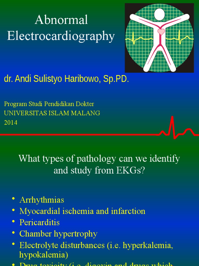 Abnormal Electrocardiography: Dr. Andi Sulistyo Haribowo, SP - PD | PDF ...