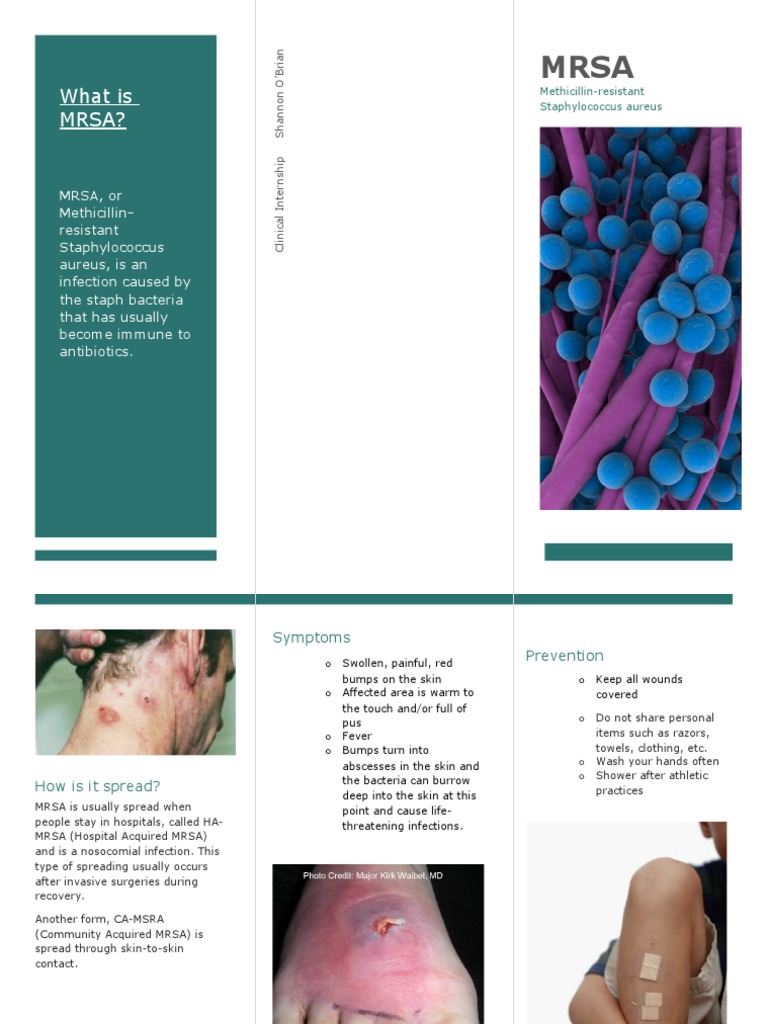 Mrsa | PDF
