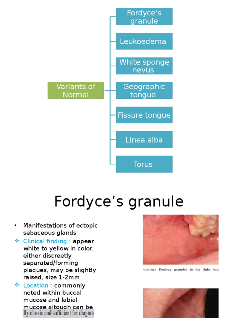 Variants of Normal | PDF | Mouth | Cutaneous Conditions