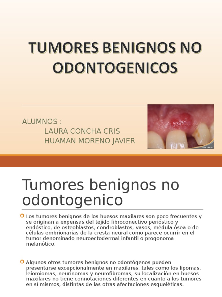 Tumores Benignos No Odontogenicos | PDF | Hueso | Especialidades Medicas