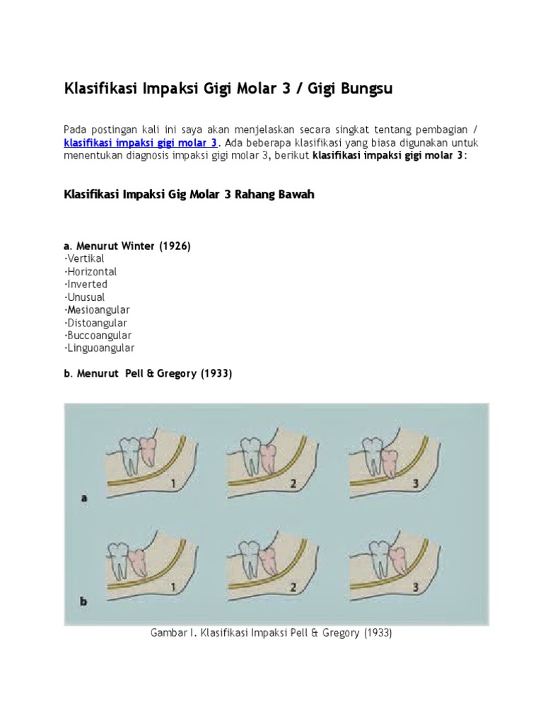 Klasifikasi Impaksi Gigi Molar 3 | PDF