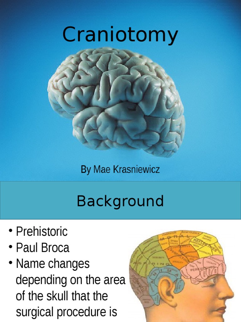 Craniotomy | Surgery | Epilepsy