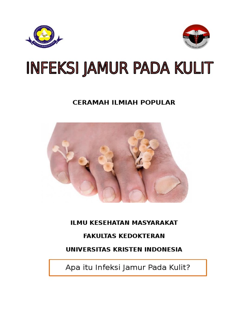 Infeksi Jamur Kulit: Penyebab dan Pencegahan | PDF