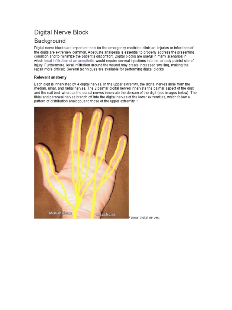 Digital Nerve Block | PDF